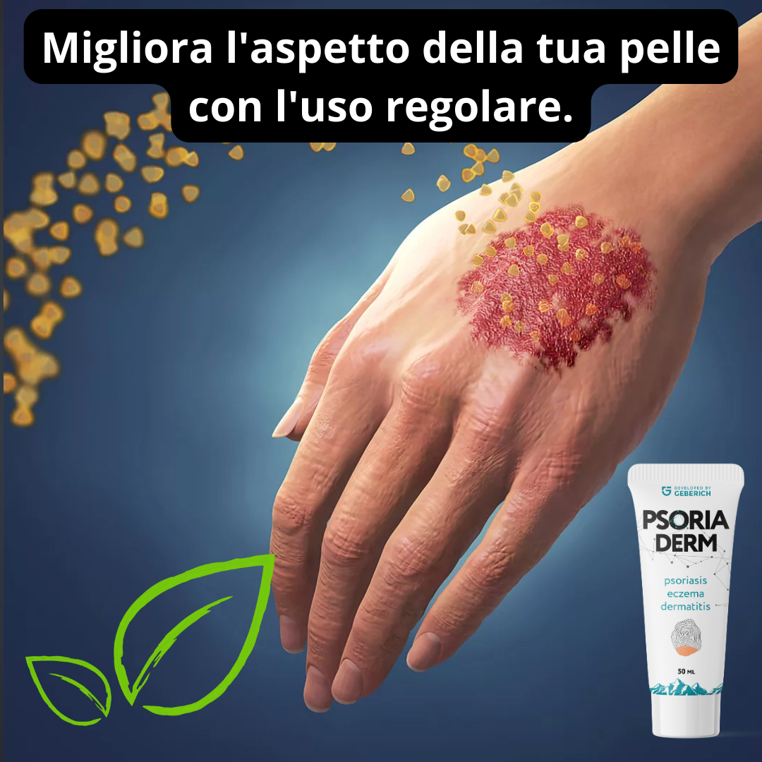 Psoriaderm work case: €22,658 income with a new nutra niche - Webvork Blog